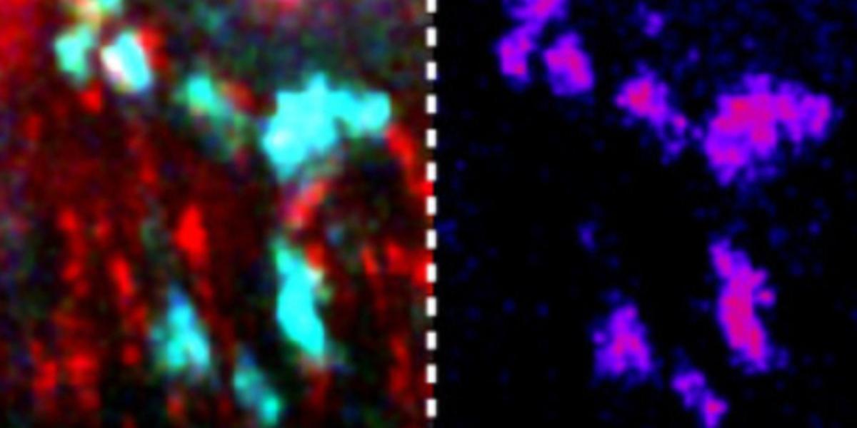 Multiple sclerosis: fateful immun … - Faculty of Medicine - LMU Munich