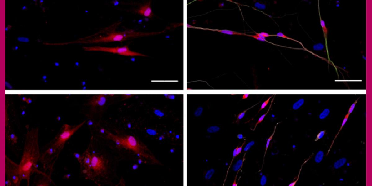 Neuronal Regeneration: New strate … - Faculty of Medicine - LMU Munich