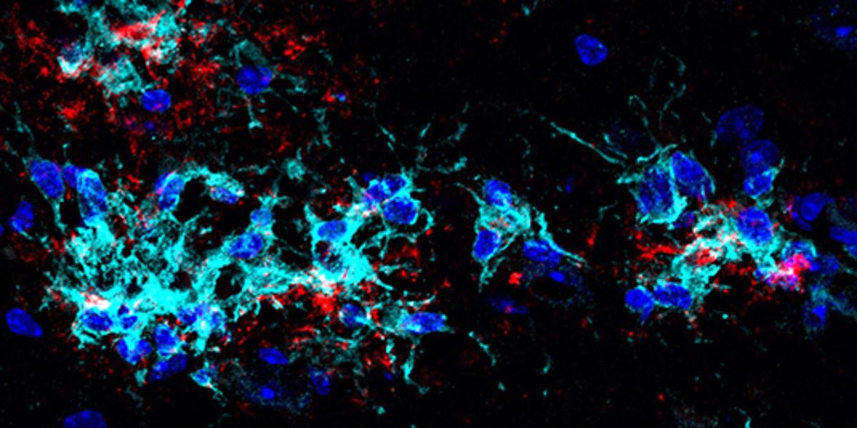 Brain immune cells have a "ravenous appetite" f … - LMU Munich
