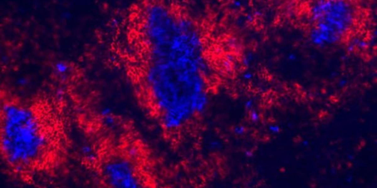How Roquin controls the activity of immune cells - LMU Munich